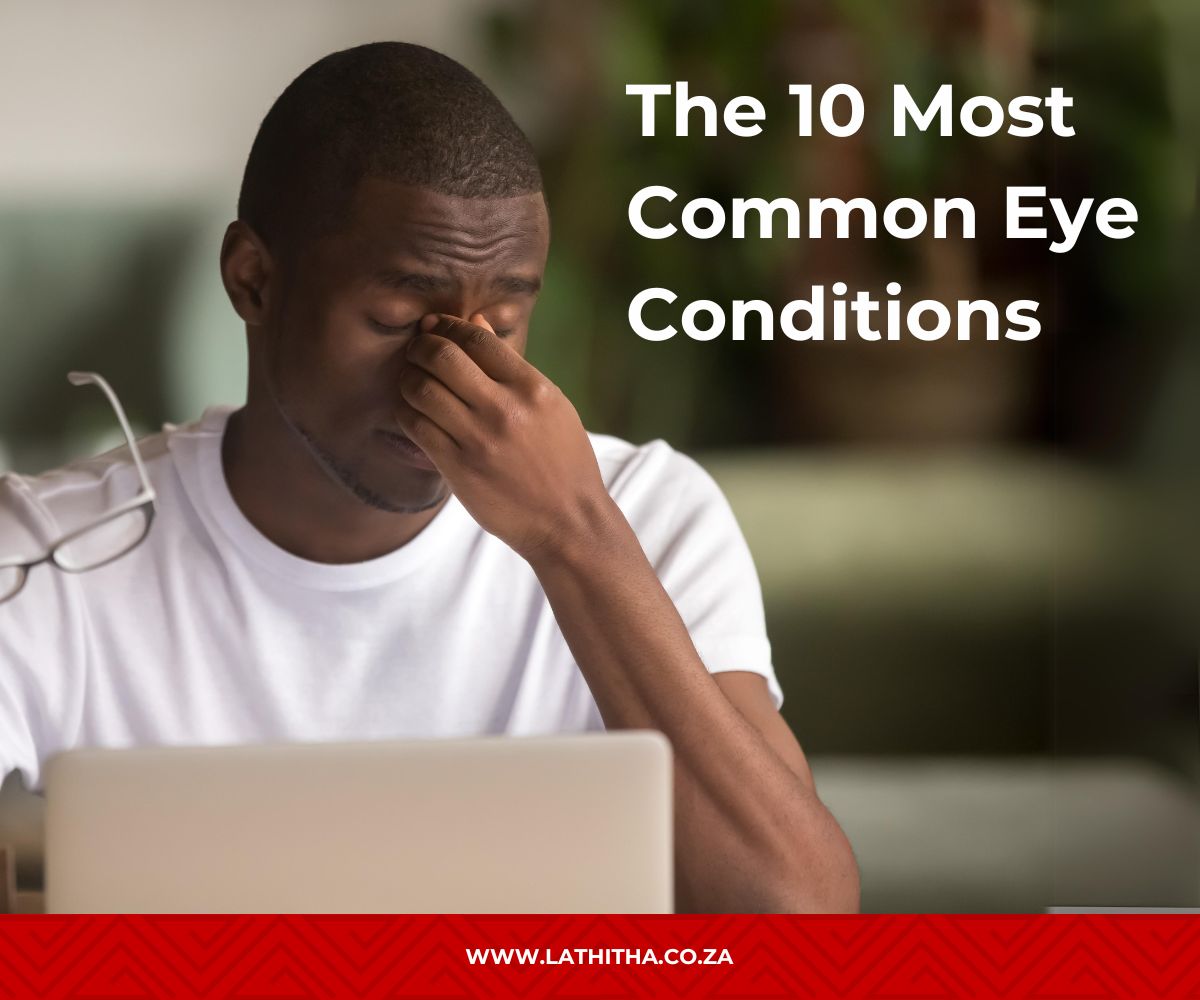 The 10 Most Common Eye Conditions: Symptoms, Causes, and Corrective ...